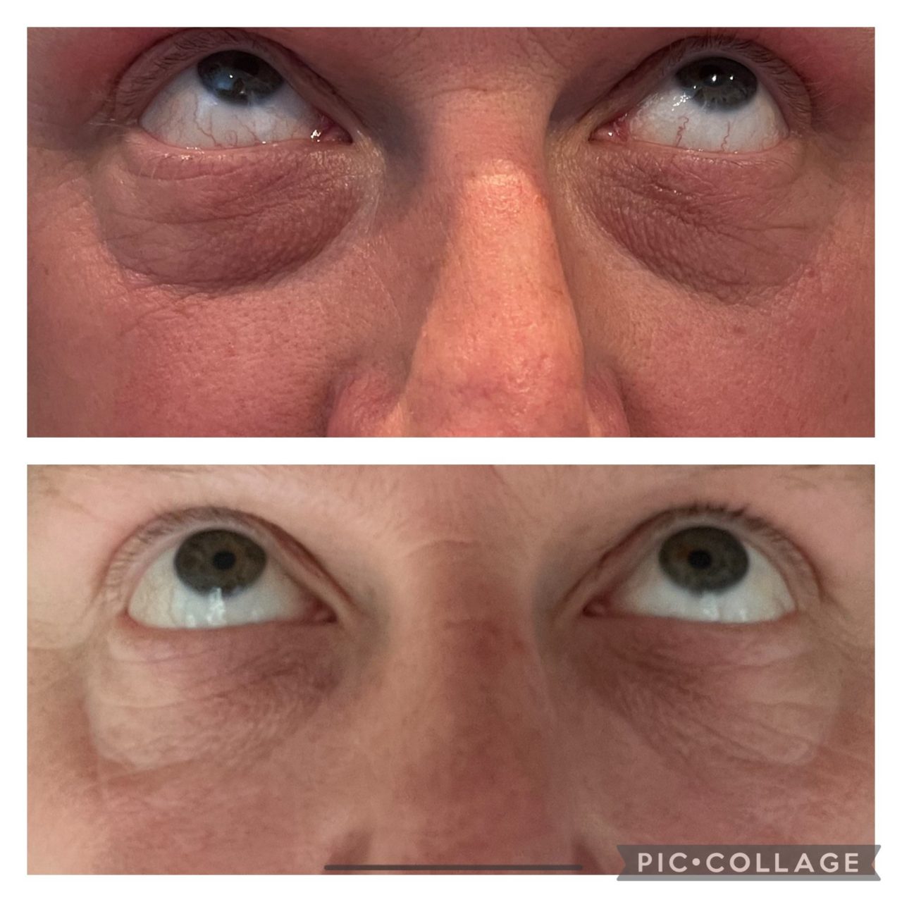 SuneKos Performa | Avenue MediSpa, Havant, Emsworth, Westbourne